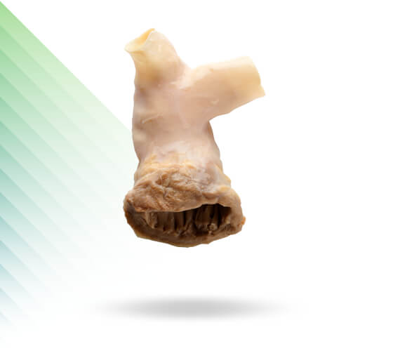 CryoValve® SG Pulmonary Human Heart Valve - Artivion